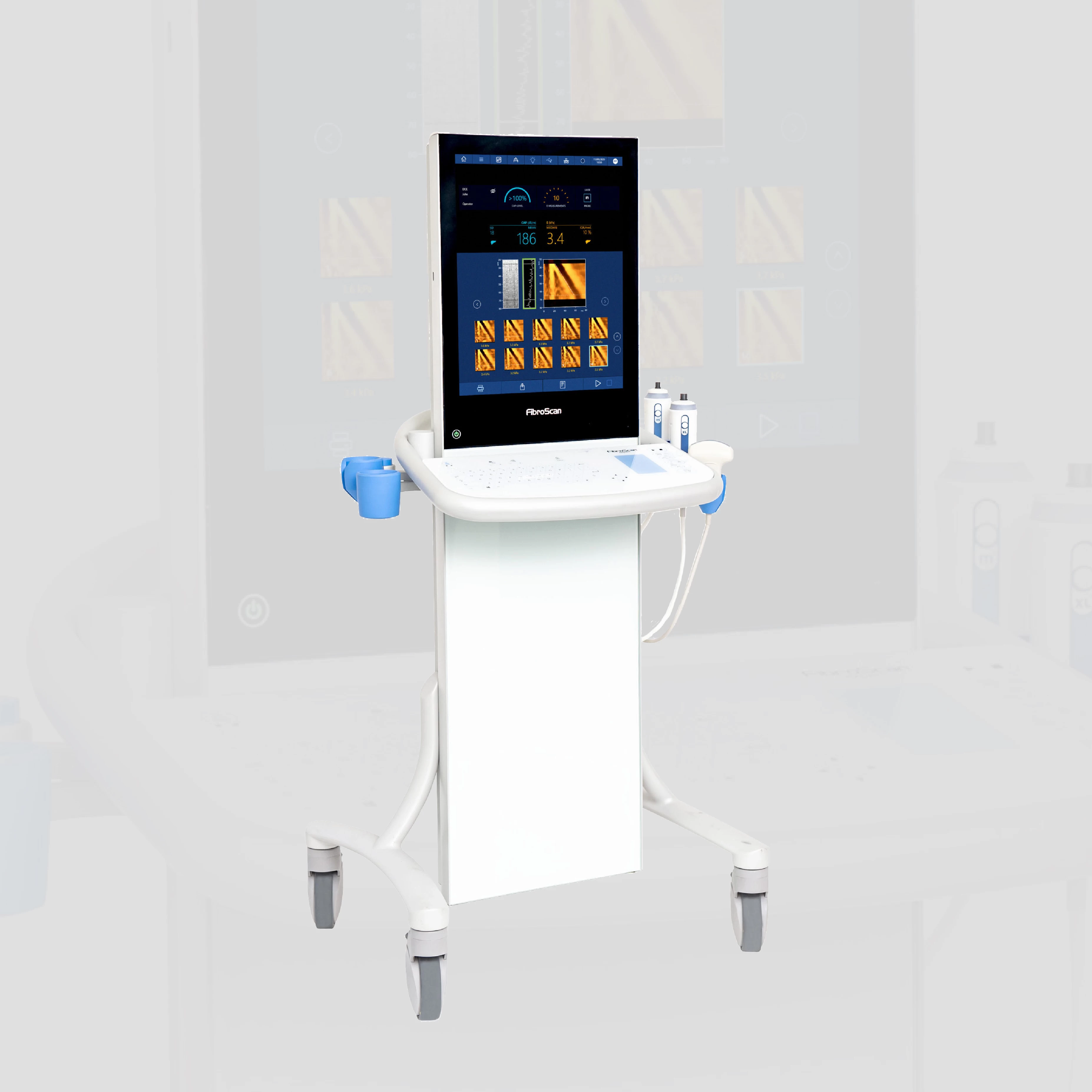EchoSense FibroScan Expert 630